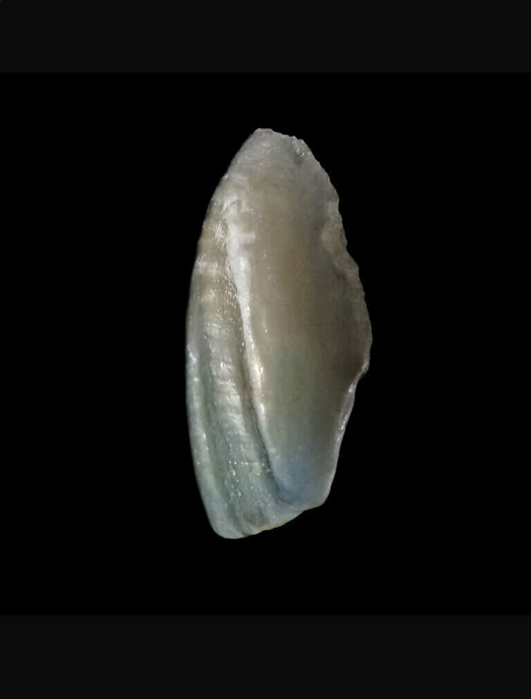 Smile Design & Veneers Dental CE Courses | The MOD Institute