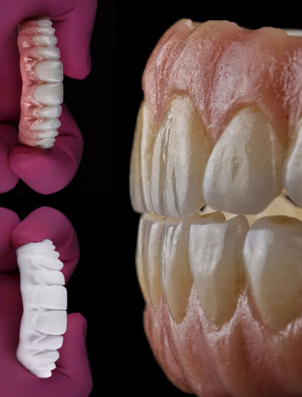 All-On-X Dental Continuing Education | The MOD Institute