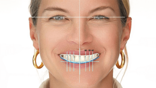 The MOD Institute | Transformative Dental CE in Charleston, SC