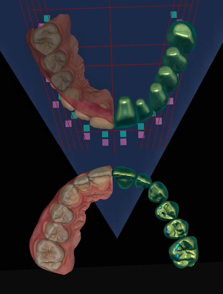 Full Mouth Restoration | Dental CE Courses | The MOD Institute