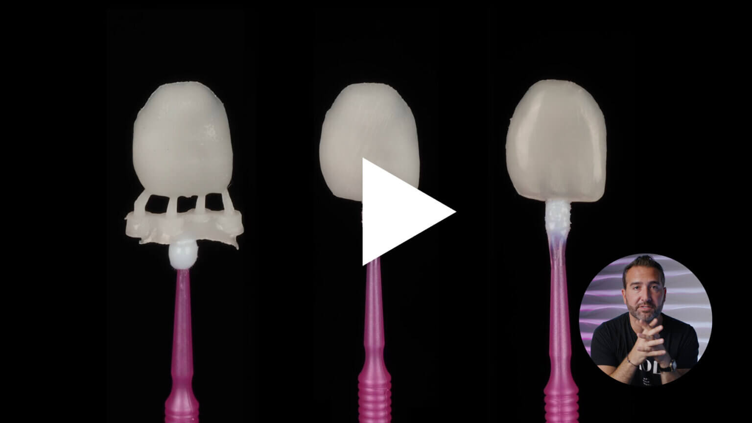 3D Printed Veneers Online Course & Follow-Along Kit - The MOD Institute
