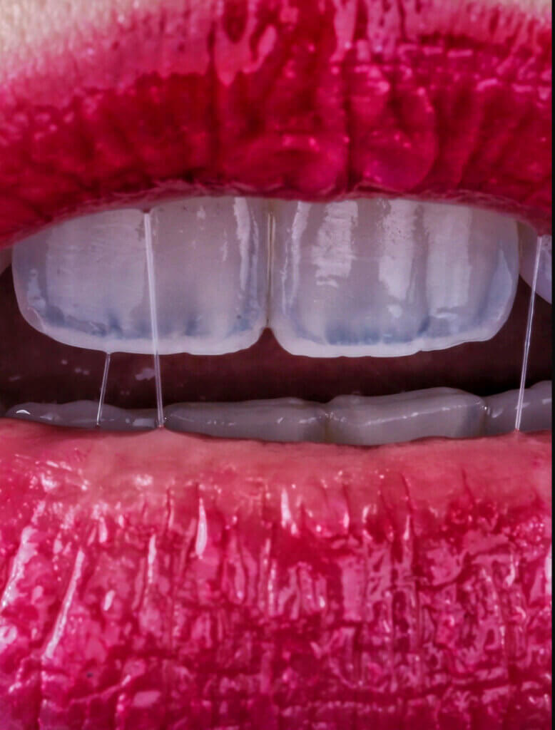 Dental Photography Courses | The MOD Institute