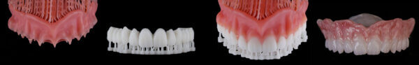 Dentures | Dental CE | The MOD Institute