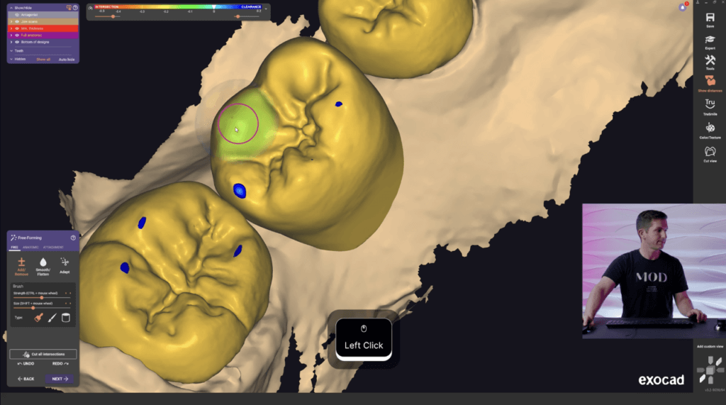 exocad Level 1: Foundations - The MOD Institute