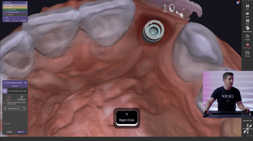 exocad Level 1: Foundations - The MOD Institute