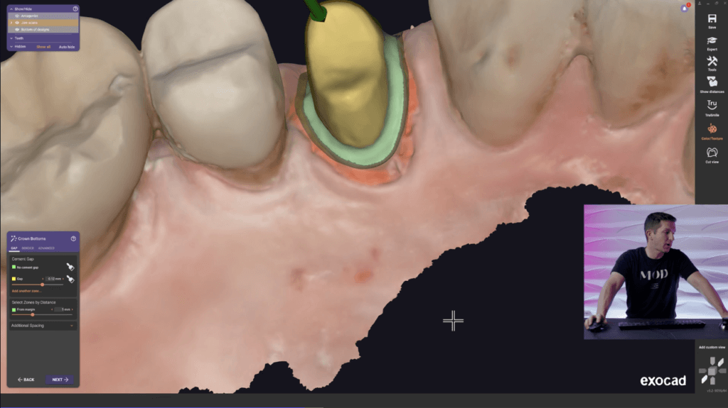 exocad Level 1: Foundations - The MOD Institute