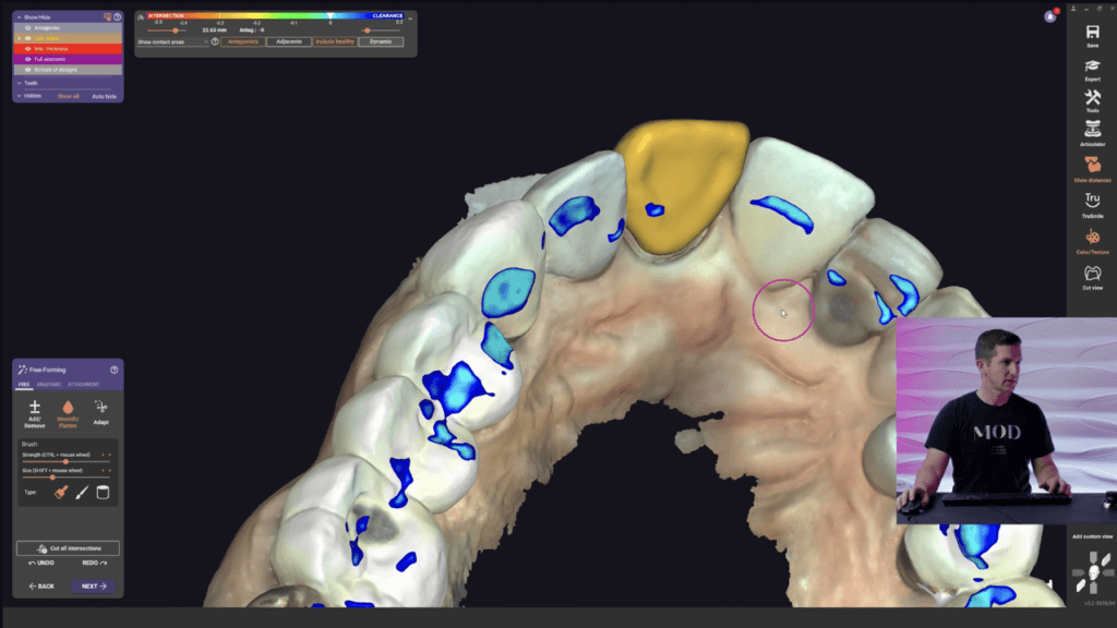 exocad Level 1: Foundations - The MOD Institute