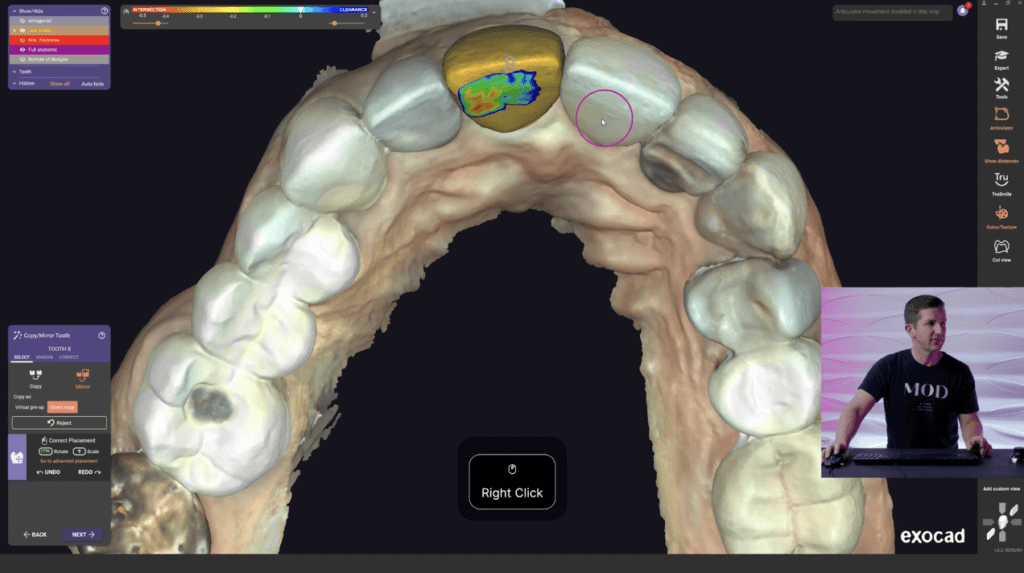 exocad Level 1: Foundations - The MOD Institute