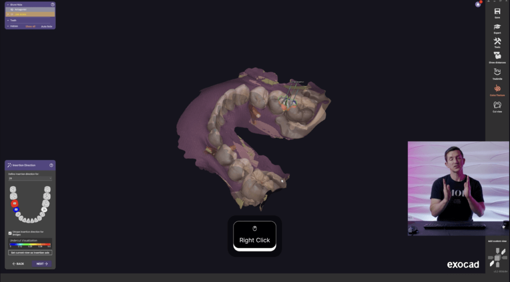 exocad Level 1: Foundations - The MOD Institute