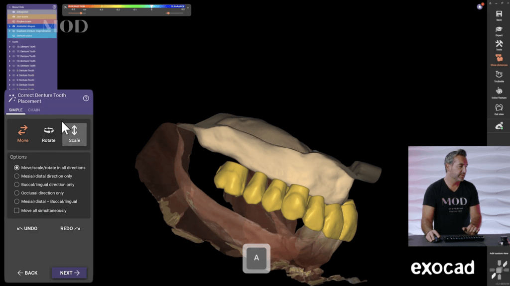 exocad Level 3: Denture Design - The MOD Institute
