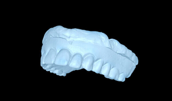 exocad Level 3: Denture Design - The MOD Institute