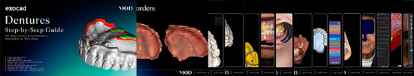 exocad: Dentures Step-by-Step Guide - The MOD Institute