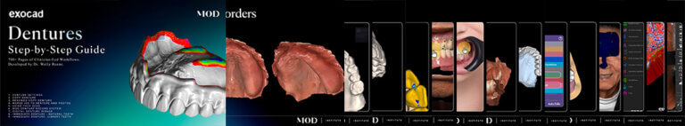 exocad: Dentures Step-by-Step Guide - The MOD Institute