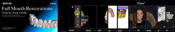 exocad Full Mouth Restorations Step-by-Step Guide - The MOD Institute