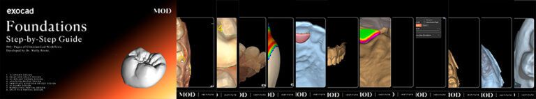 exocad Foundations Step-by-Step Guide - The MOD Institute