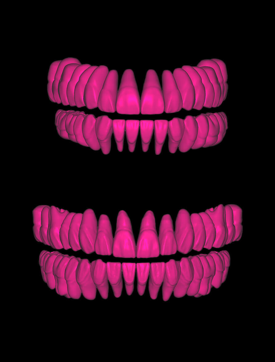 MOD exocad Tooth Libraries - The MOD Institute